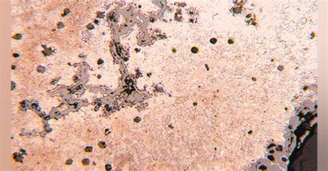 Reducing Slag And Dross In Ductile Iron Castings Foundry Management And Technology