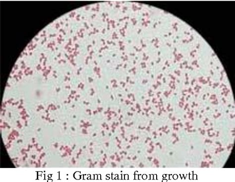 Table 1 From Isolation Of Acinetobacter Species From Pus Samples In A Tertiary Care Hospital