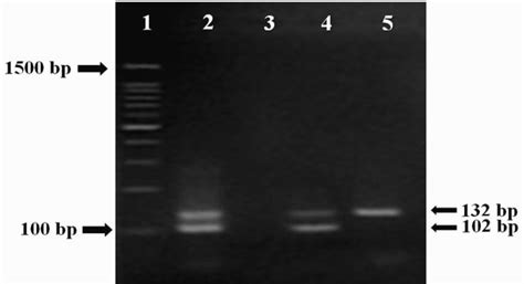 Figure 1 From Detection Of Gene Encoding Enterotoxin A In Staphylococcus Aureus Isolated From