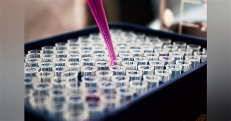Labcorp To Acquire Toxikon Expanding Non Clinical Testing Capabilities