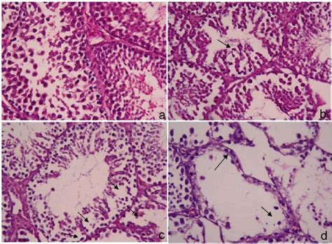 A Testis Of Mice In Control Group Showing The Normal Histological Download Scientific