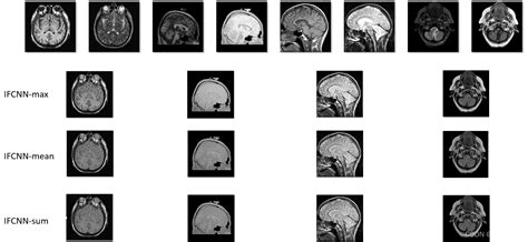 A General Image Fusion Framework Based On Convolutional Neuralnetwork（一种基于卷积神经网络的通用图像融合框架）ifcnn