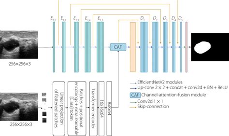 Multi Task Approach Based On Combined Cnn Transformer For Efficient