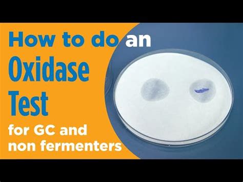 Oxidase Test Vetbact