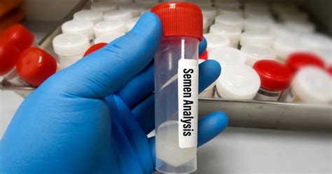 Study Unveils Causes Of Sperm Count Reduction In The World Switch News