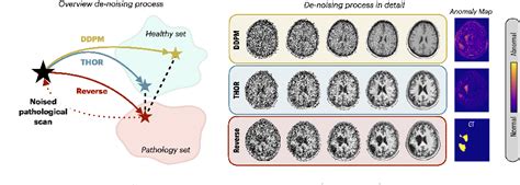 Diffusion Models With Implicit Guidance For Medical Anomaly Detection Paper And Code