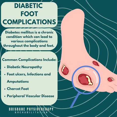 Diabetic Foot Complications Brisbane Physiotherapy And Podiatry