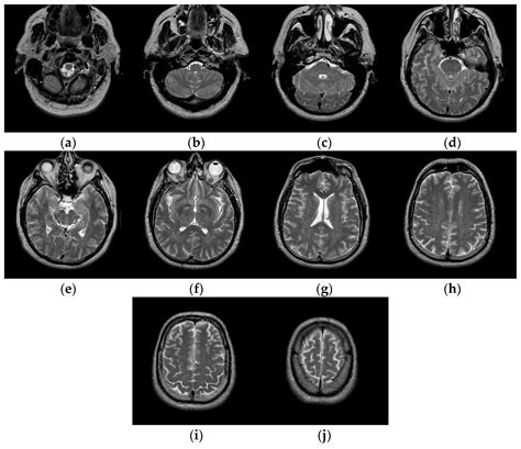 A Novel Interval Iterative Multi Thresholding Algorithm Based On Hybrid
