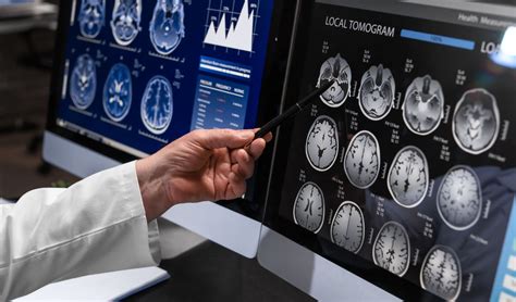 Resonancia Magnética Abierta Vs Resonancia Magnética Cerrada ¿cuál