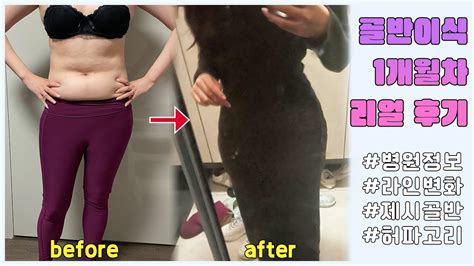 골반이식 1개월차 후기ㅣ달라진 골반라인덕분에 옷입을때 행복해요 ️ Youtube