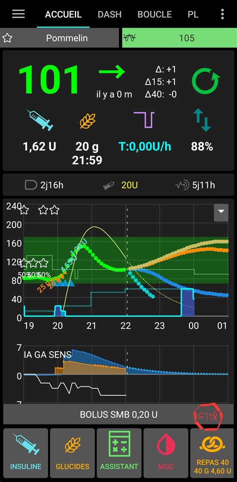 Feature Request Ability To Stop Smb · Issue 2572 · Nightscout