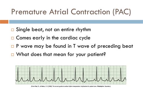 SOLUTION Basic Rhythm Interpretation With Practice Answers Studypool