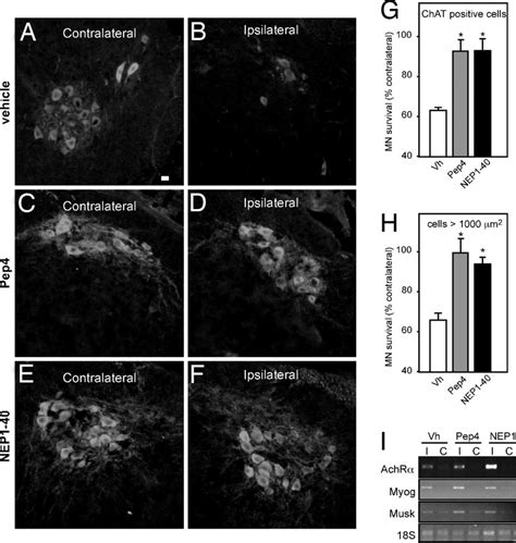 Pep4 And Nep1 40 Prevent Motor Neuron Death After Sciatic Nerve Axotomy Download Scientific