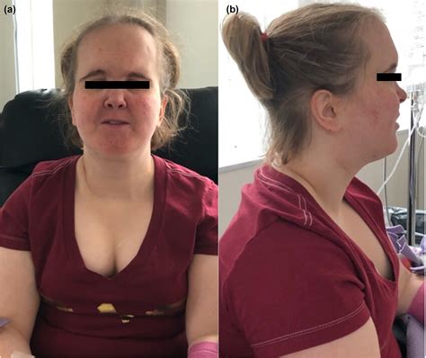 Craniofacial Presentations Of A 28 Year Old Female Patient With Download Scientific Diagram