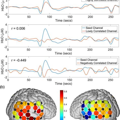 A Demonstration Of Resting State Connectivity Differences Among Download Scientific Diagram