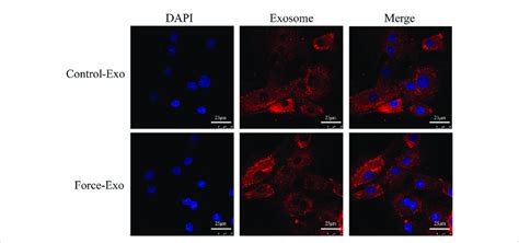 Dye Based Tracing Of Exosomal Uptake By Rat Condylar Chondrocytes