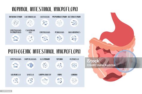 장 내 미생물 위장 창 자 창 자에 대 한 정상 및 병원 성 박테리아 좋은 나쁜 미생물 미생물군유전체 벡터 플랫 만화 일러스트레이션 전단지 의료 브로셔 배너에 적합 아구창에