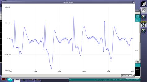 Github Srivera1ecg Ecg With An Ads1293 Adc And Arduino
