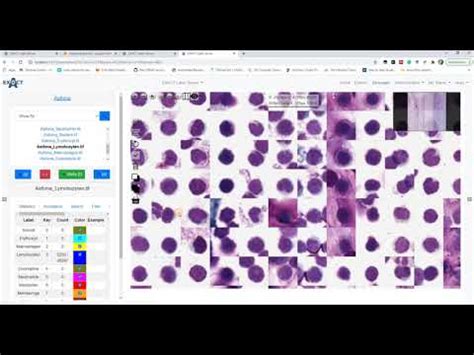 Github Deepmicroscopy Exact An Open Source Online Platform For Collaborative Image Labeling