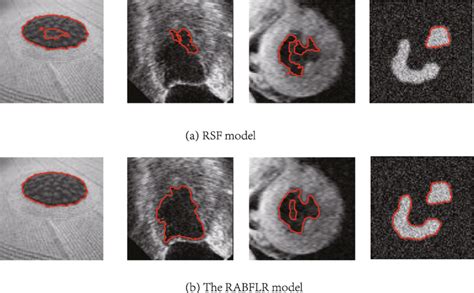 Segmentation Results Of Rabflr Model And Rsf Model For Noisy Images A Download Scientific