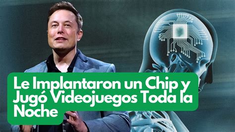 Exitoso Implante Cerebral De Neuralink Chihuahua Noticias