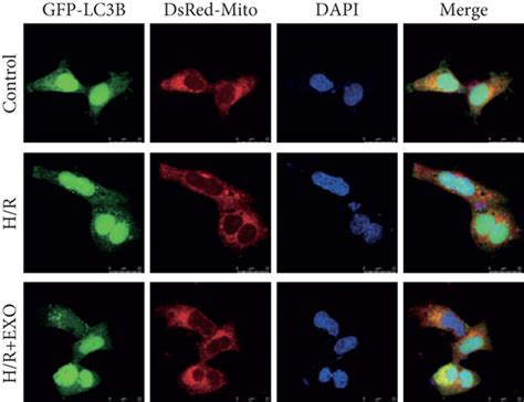 Bmsc Derived Evs Suppressed Apoptosis And Inflammasome Activation And