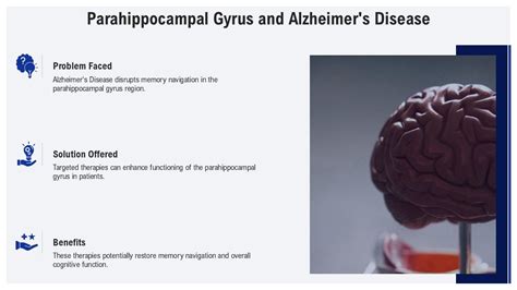 Parahippocampal Gyrus Brain Memory Navigation Region Ppt Template St Ai