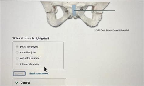 Solved Which Struct Which Structure Is Highlighted Pubic Chegg