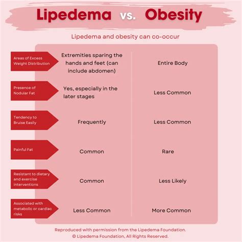 Clinician Resources For Lipedema Diagnosing Stages Types Surgery In Canada
