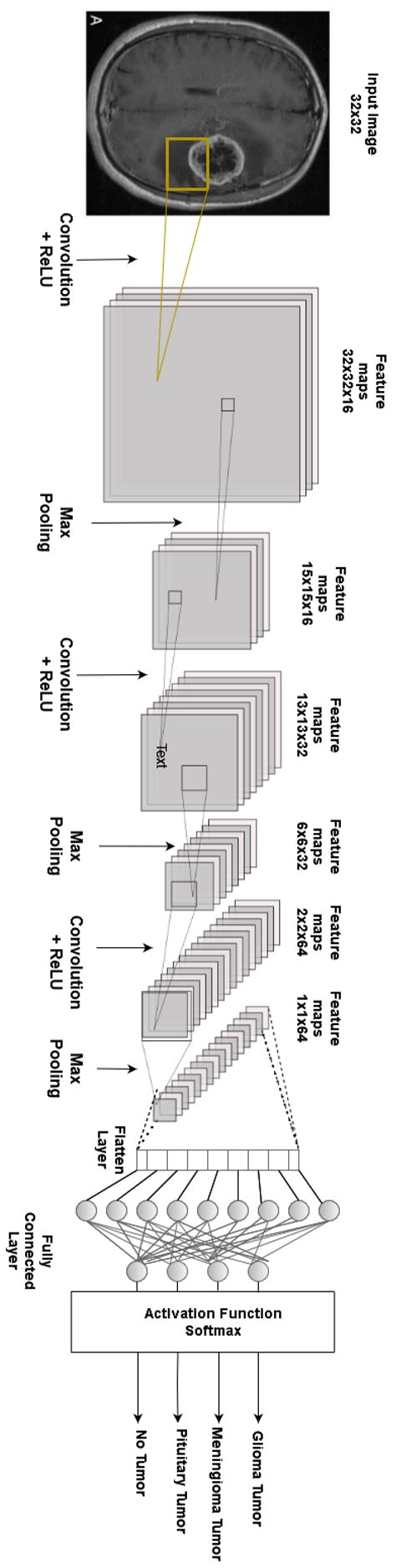 Algorithms Free Full Text A Deep Analysis Of Brain Tumor Detection From Mr Images Using Deep