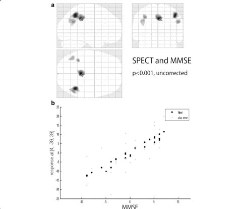 A Voxel Wise Correlations Between Cognition Measured With Mmse And Cbf Download Scientific