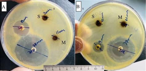 Antibiogram Test Results Of Antibiotics And Phytochemicals Used In The Download Scientific
