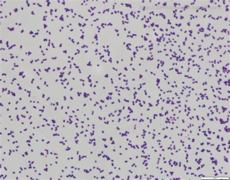 Enterococcus Microscopy Enterococcus Gramstain And Cell