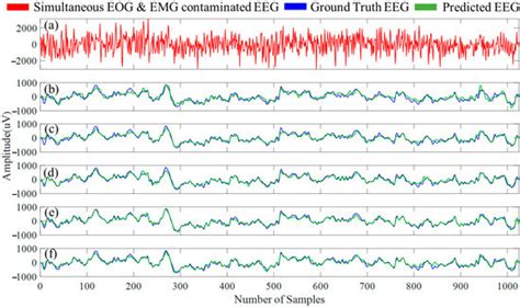 Bioengineering Special Issue Machine Learning And Signal Processing