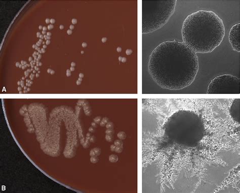 Candida Albicans Microscopic Morphology