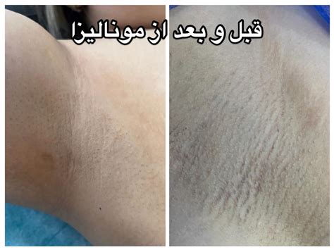 ‎دکتر لیلی خادمیمتخصص زنان و زایمان‎ Drleiligyn • Instagram Photos