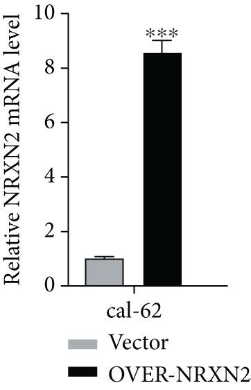 Nrxn2 Expression Was Downregulated In Thca A Differences In Nrxn2 Download Scientific
