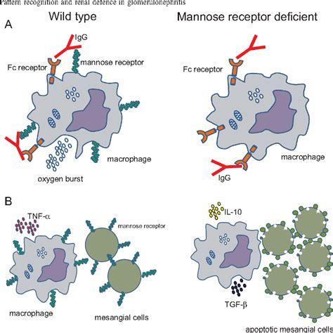 Figure 1 From Pattern Recognition And Renal Defence In Crescentic