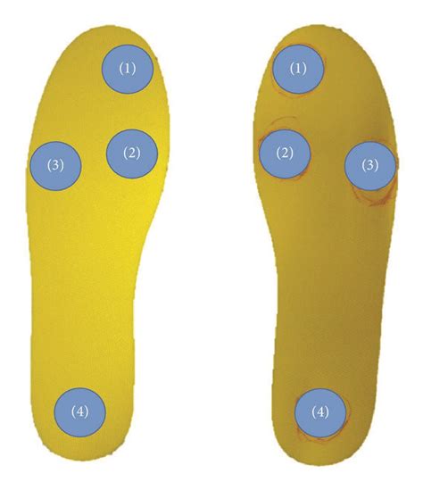 Plantar Pressure Sensor Distribution Download Scientific Diagram