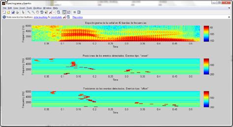 Above 40 Band Spectrogram Of The Word One Center Representation Of