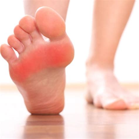 Plantar Plate Dysfunction The Podiatry Group