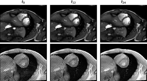 Figure 1 From Myocardial Segmentation Of Tagged Magnetic Resonance Images With Transfer Learning