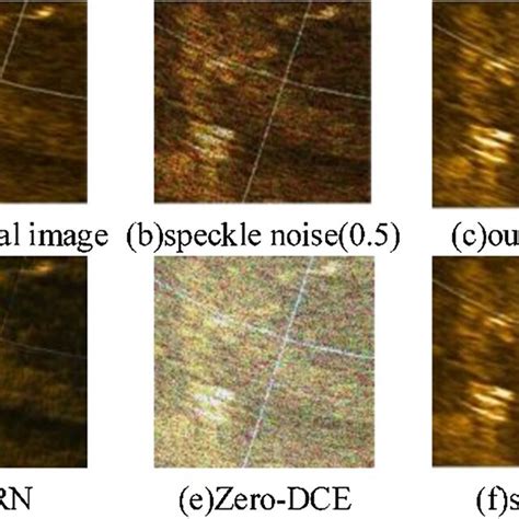 Examples Of The Constructed Dataset For Speckle Reduction Download Scientific Diagram