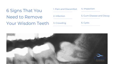 Can Wisdom Teeth Fall Out On Their Own
