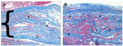 A Histologic Appearance Of The Acellular Xenograft At 7 Days Post Download Scientific Diagram