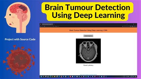 Brain Tumour Detection Project Using Deep Learning From Mri Image