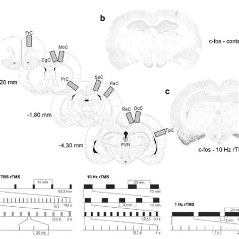 A Schematic Drawing Of Frontal Sections Of Rat Brain Relative To Bregma