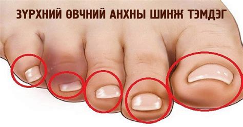 Таны зүрх өвчилж эхлэж байгааг мэдэгдэх шинж тэмдгүүд Үүнийг мэдэж