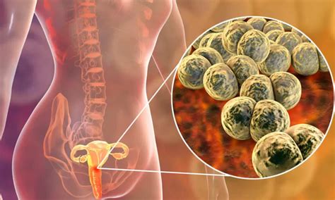 Gonorrea Y Resistencia Antibiótica Circular 043 De 2018 Consultorsalud