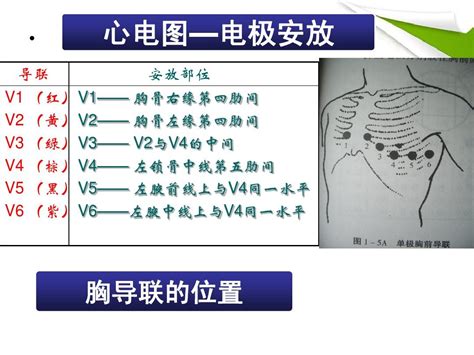 五导联的位置示意图 三导联的位置示意图 5导联电极的位置图解 大山谷图库